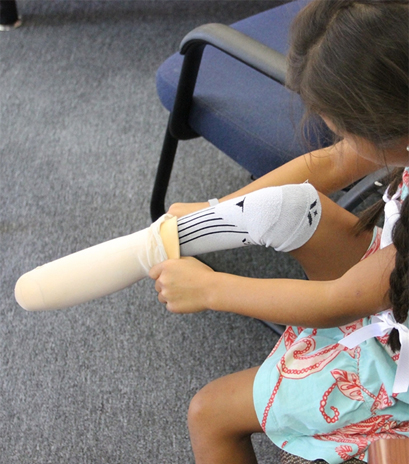 Amputee Blade Runners – We offer free running legs, through grants, to ...